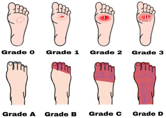 Hyperglycaemia-Linked Diabetic Foot Complications and Their Management ...