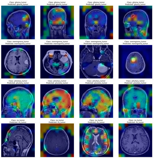 AI Approaches in Computer-Aided Diagnosis and Recognition of Neoplastic ...