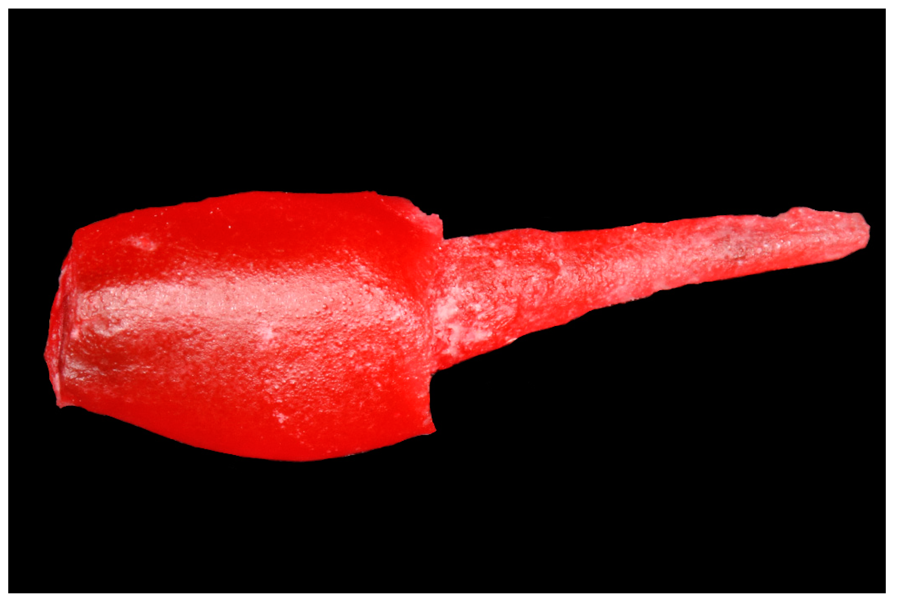 In Vitro Study Comparing Retention of Custom Post and Cores Fabricated ...