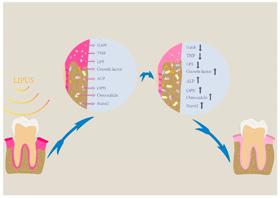 Clinical Applications of Low-Intensity Pulsed Ultrasound and Its ...