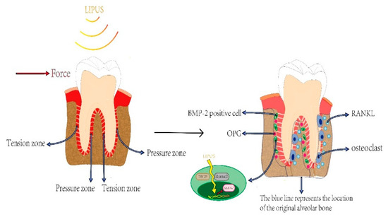 Clinical Applications of Low-Intensity Pulsed Ultrasound and Its ...