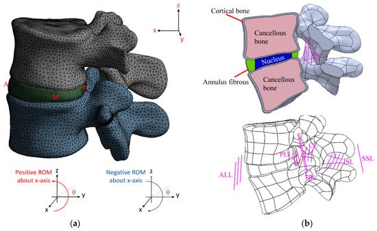 Assessment of Spinal Stability after Discectomy Followed by Annulus ...