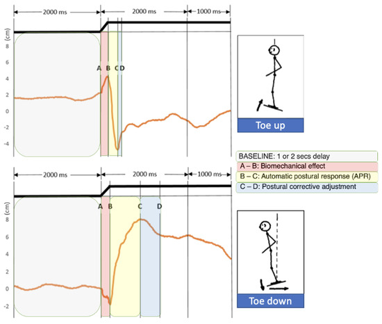 A Study Protocol to Evaluate the Effects of Vestibular Training on the ...
