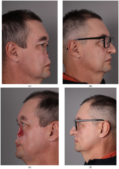Implementation of Cone Beam Computed Tomography, Digital Sculpting and ...