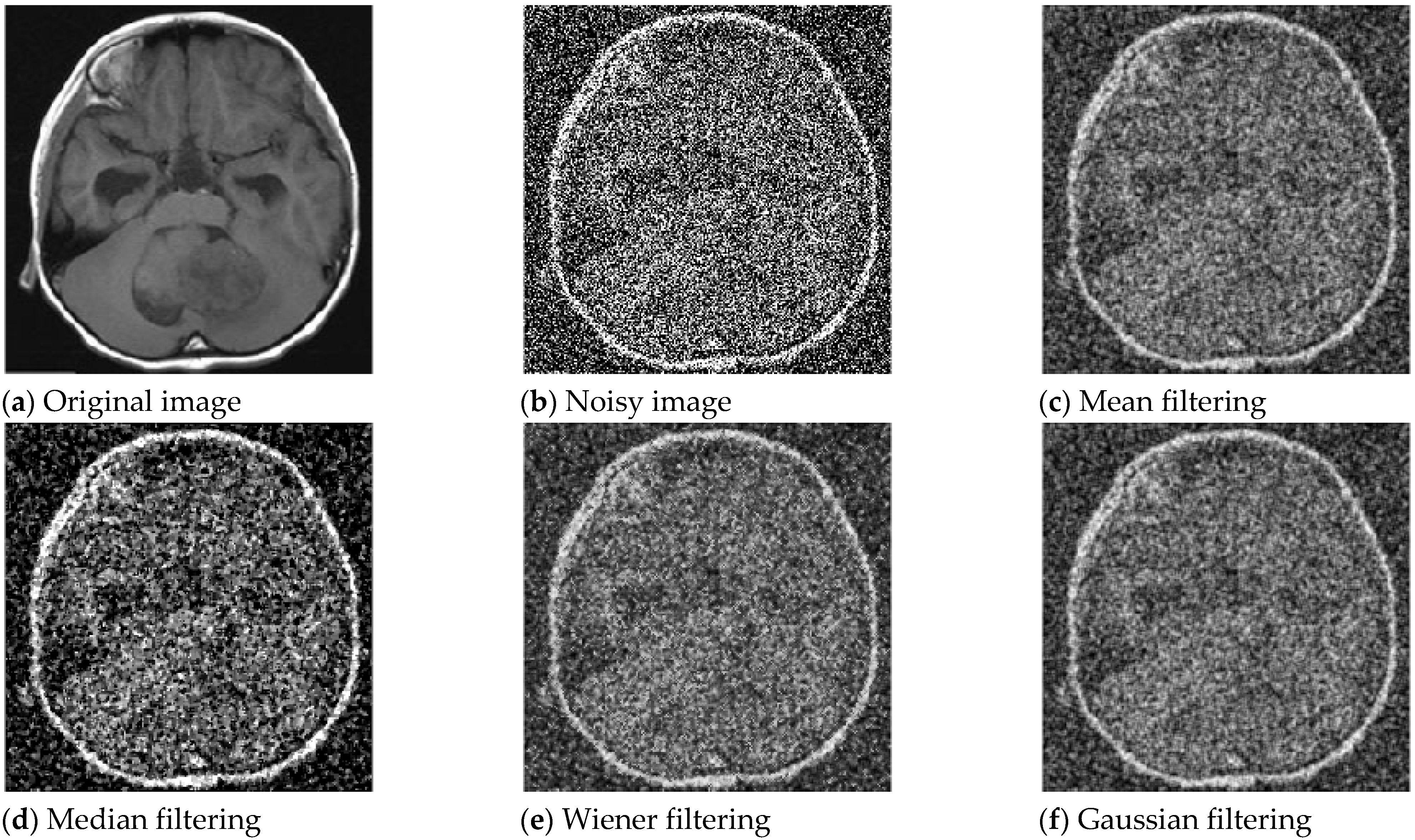 Gray Image Denoising Based on Array Stochastic Resonance and Improved ...