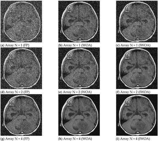 Gray Image Denoising Based on Array Stochastic Resonance and Improved Whale Optimization Algorithm