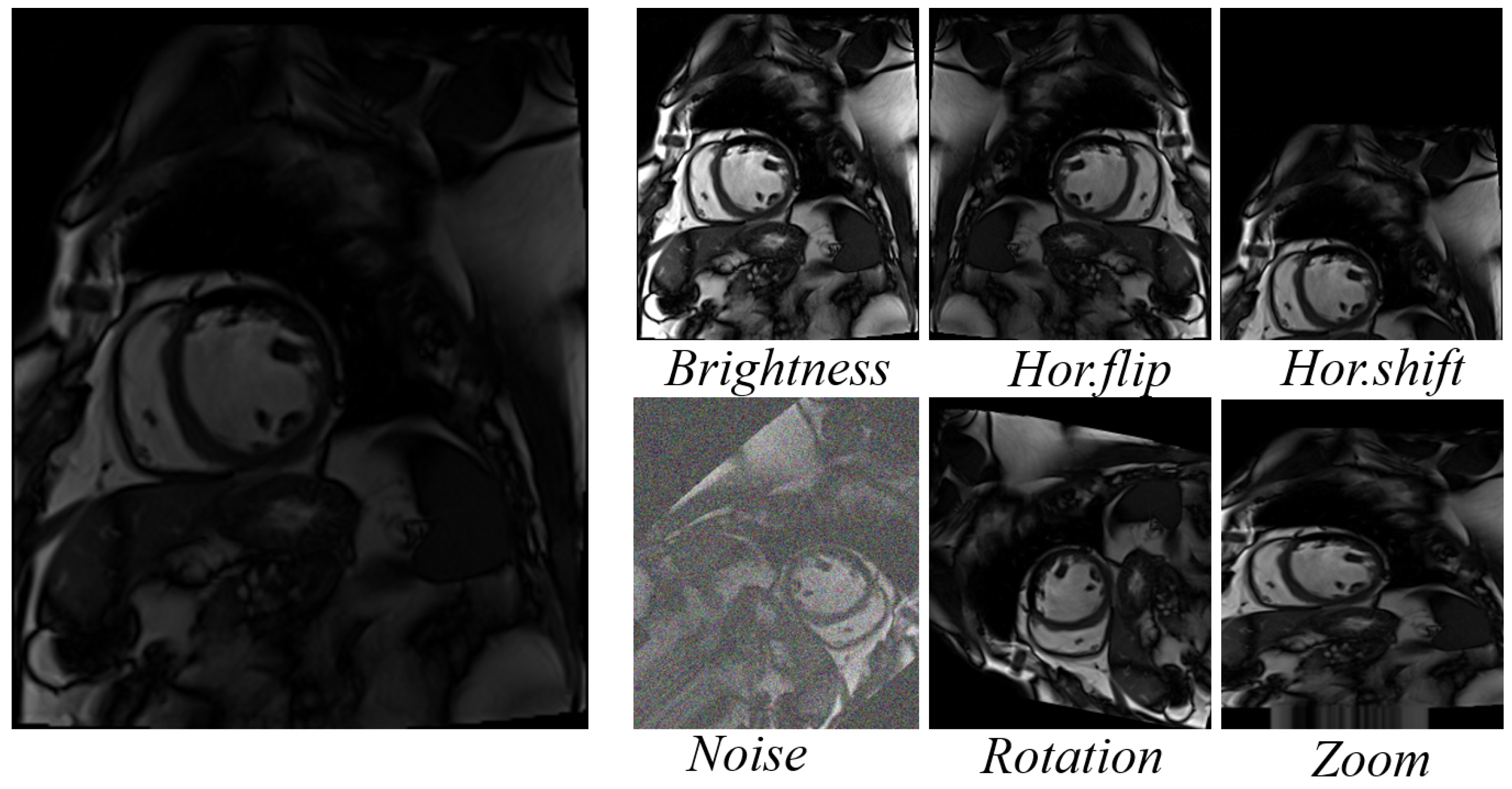 Learning Deep Representations of Cardiac Structures for 4D Cine MRI ...