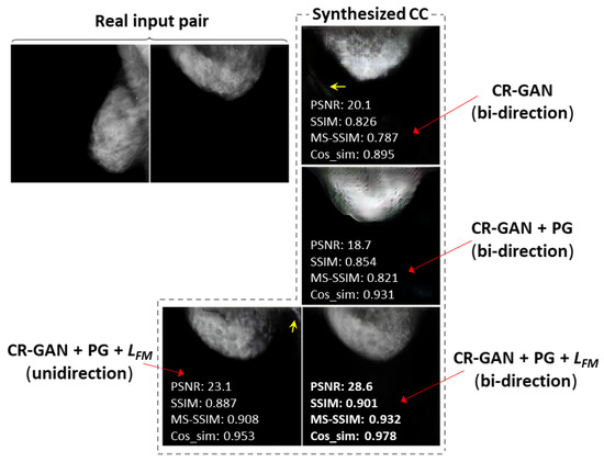 Two-View Mammogram Synthesis from Single-View Data Using Generative ...