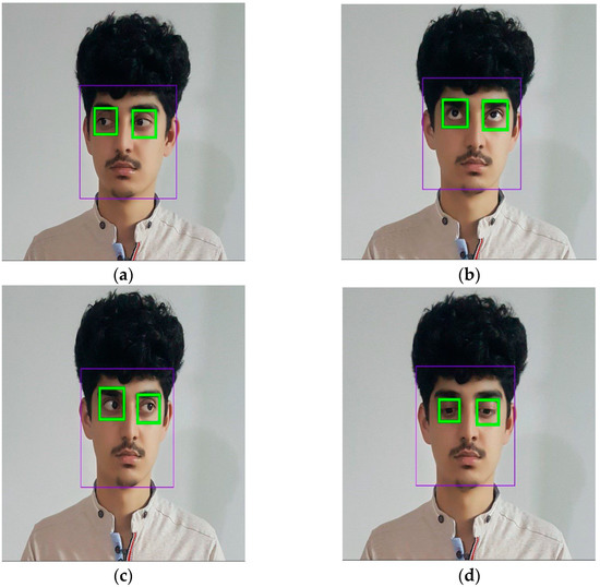 Towards Automatic Detection of Social Anxiety Disorder via Gaze Interaction