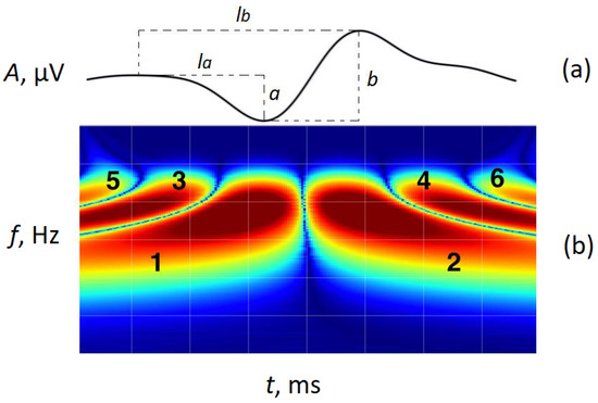 Advanced Analysis of Electroretinograms Based on Wavelet Scalogram ...