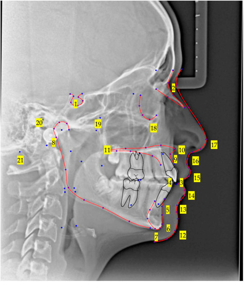 Verification of Convolutional Neural Network Cephalometric Landmark Identification
