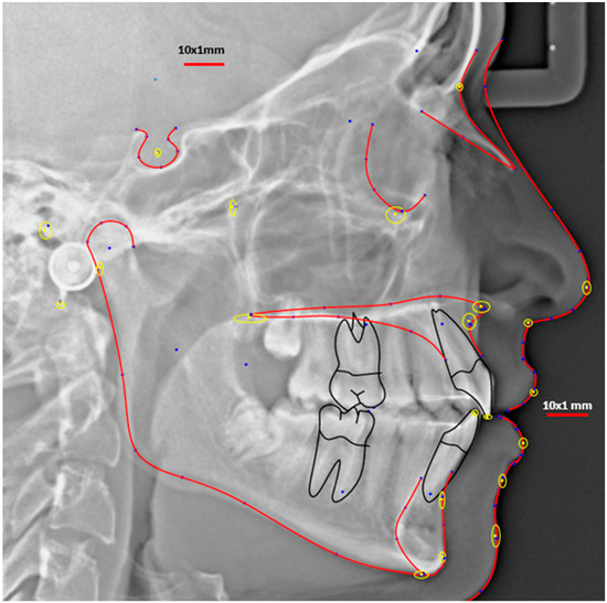 Verification of Convolutional Neural Network Cephalometric Landmark Identification