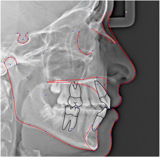 Verification of Convolutional Neural Network Cephalometric Landmark ...