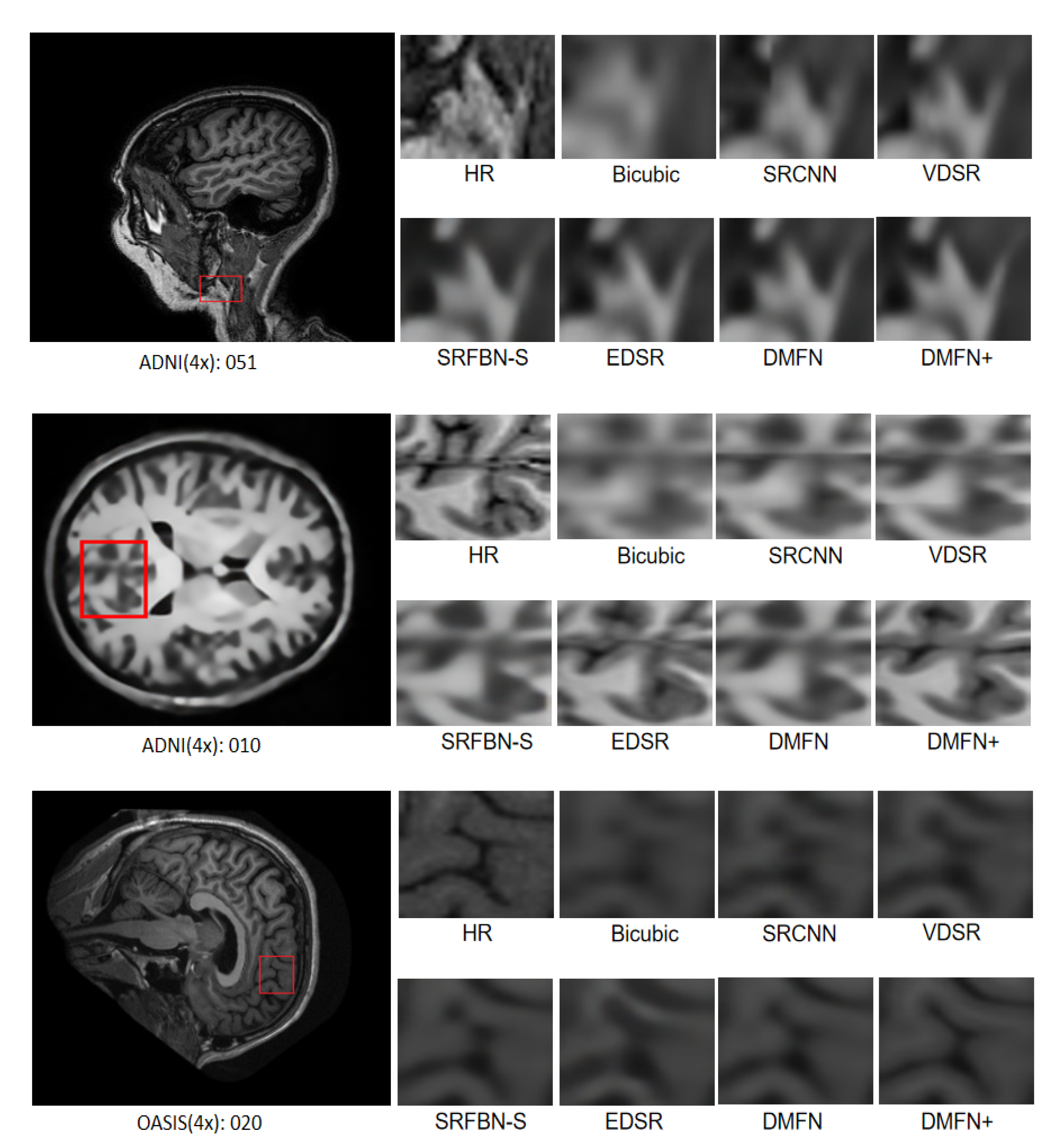 Lightweight Dual Mutual-Feedback Network for Artificial Intelligence in Medical Image Super ...