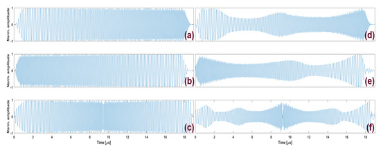 Simultaneous Coded Plane-Wave Imaging Using an Advanced Ultrasound ...