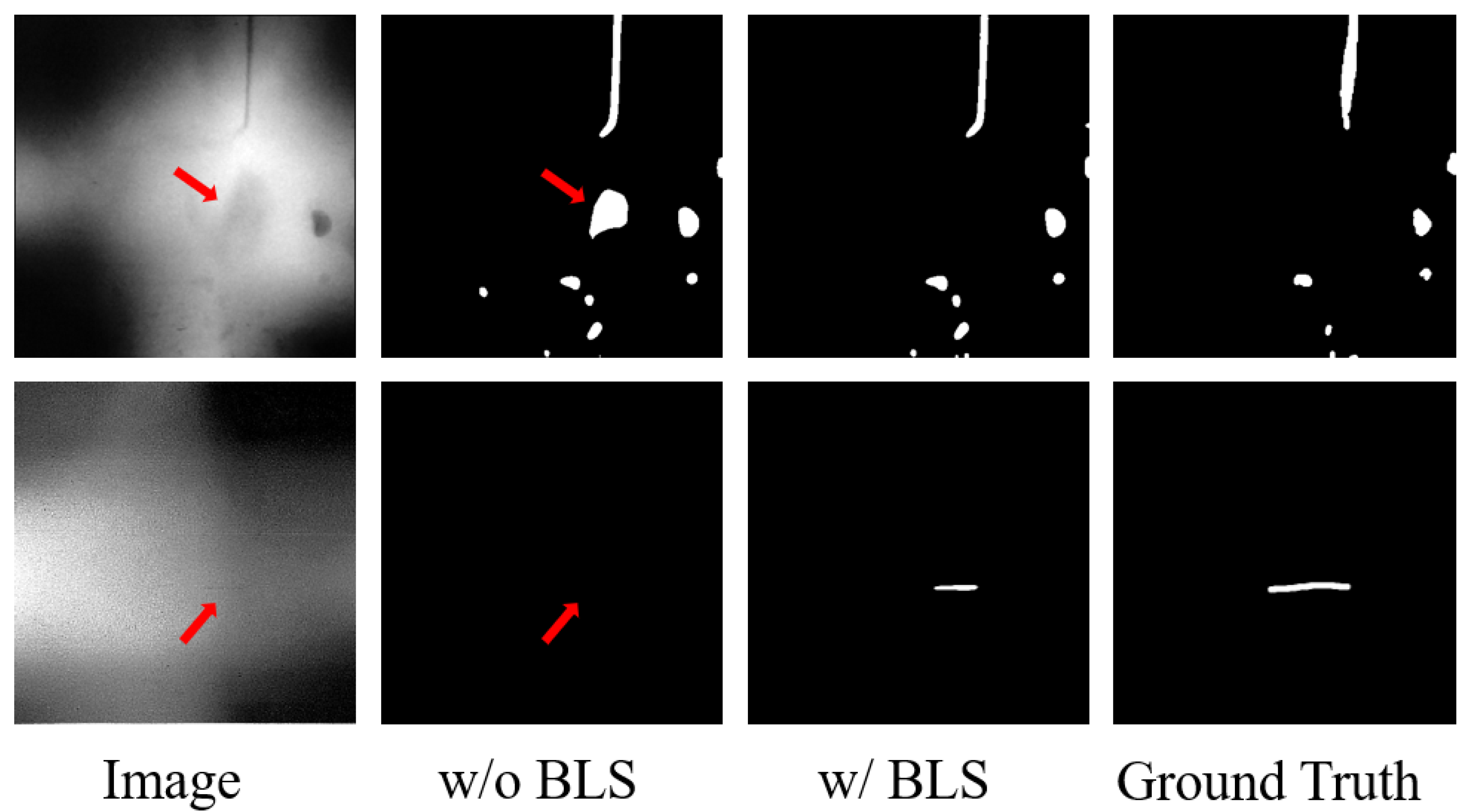 Applied Sciences | Free Full-Text | Weld Defect Segmentation in X-ray Image with Boundary Label ...