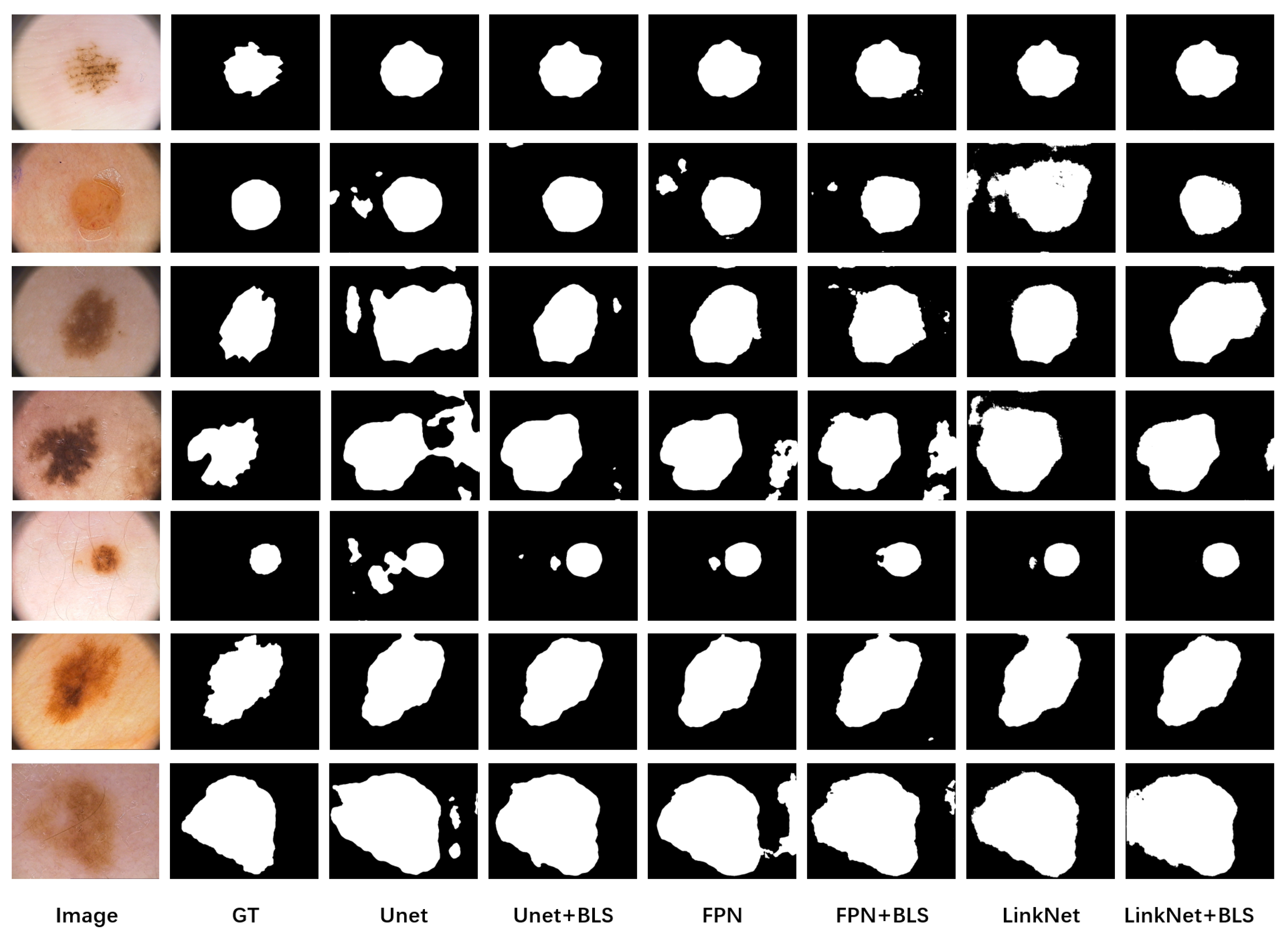 Applied Sciences | Free Full-Text | Weld Defect Segmentation in X-ray ...
