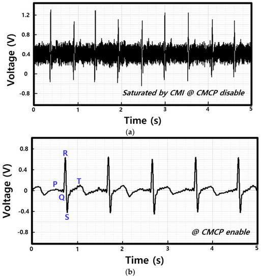 Low-Noise, Low-Power Readout IC for Two-Electrode ECG Recording Using ...