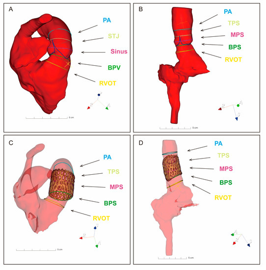 Straightened Segmentation in 4D Cardiac CT: A Practical Method for ...