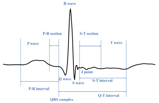 Improving ECG Classification Performance by Using an Optimized One-Dimensional Residual Network ...