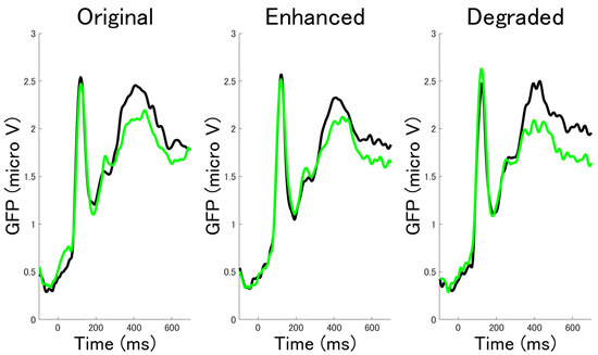 Applied Sciences | Free Full-Text | Multivariate ERP Analysis of Neural ...