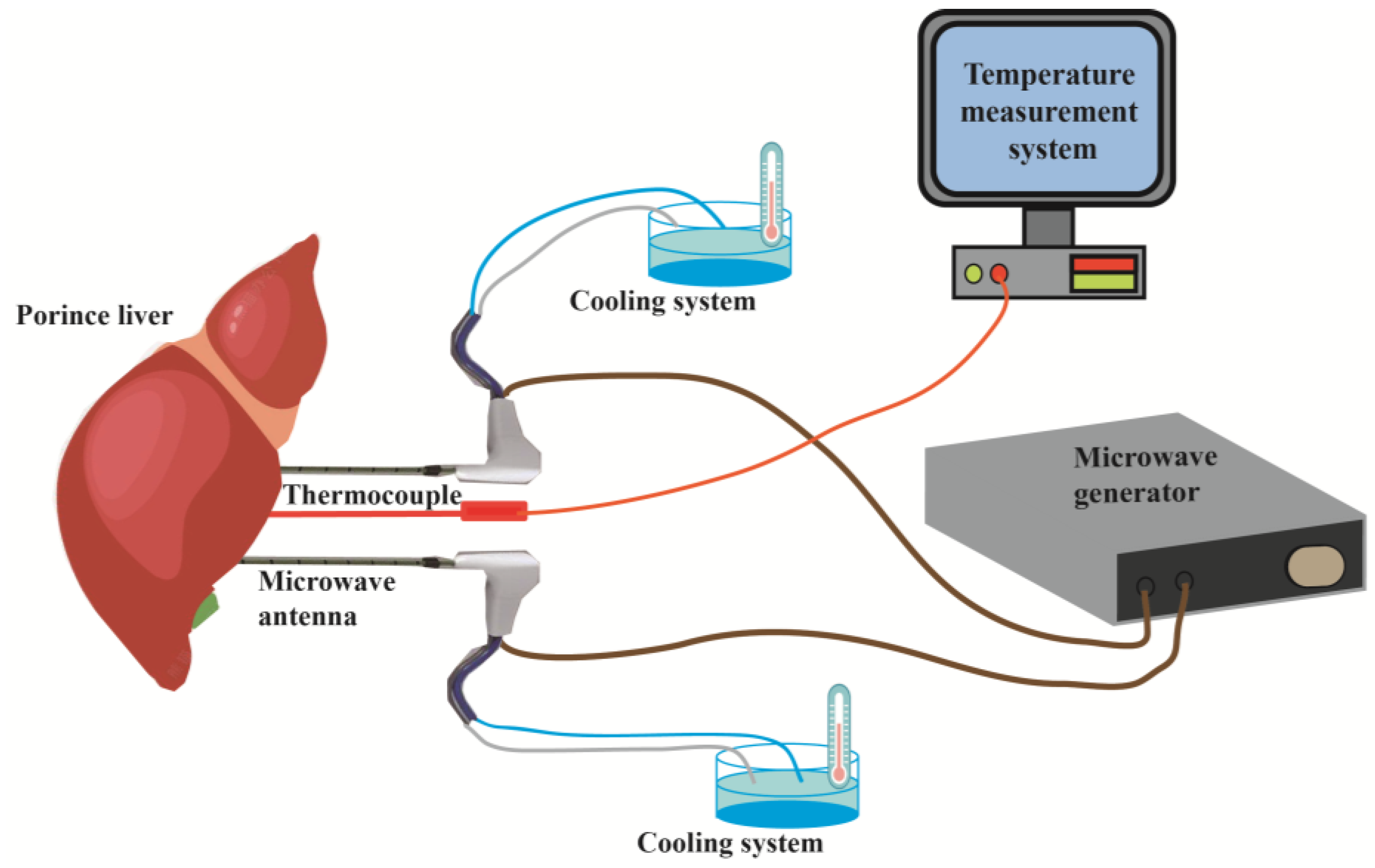 Applied Sciences | Free Full-Text | Computer Simulations of Dual-Antenna Microwave Ablation and ...