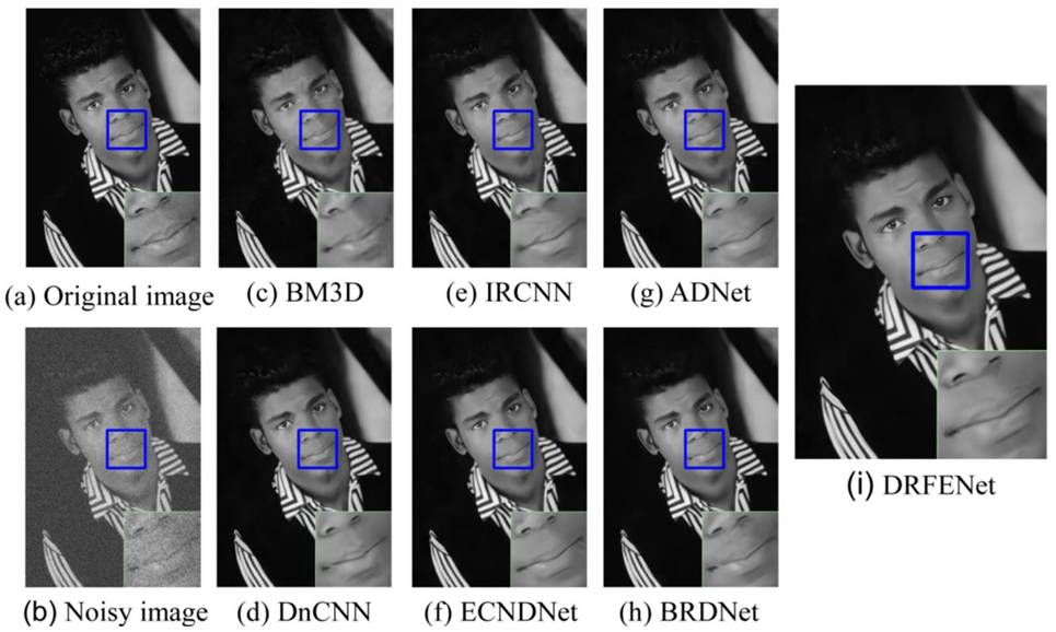 Applied Sciences | Free Full-Text | DRFENet: An Improved Deep Learning ...