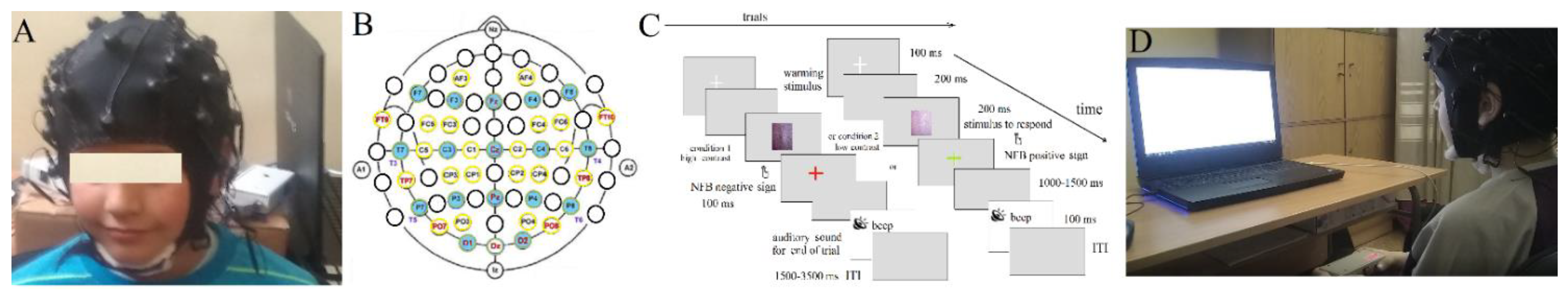 A Wireless EEG System for Neurofeedback Training