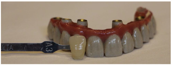Colour Changes of Acetal Resins (CAD-CAM) In Vivo