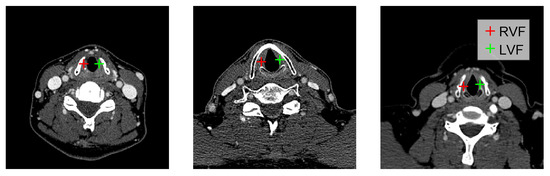 Applied Sciences | Free Full-Text | Reinforcement Learning Based Vocal ...