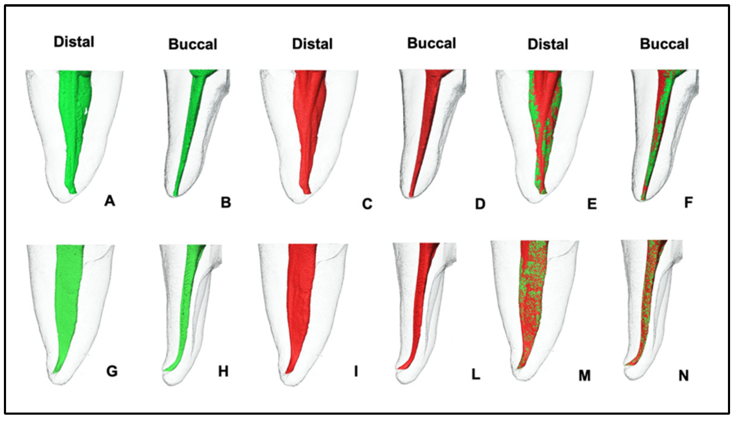The Influence of Brushing Motion on the Cutting Efficiency of Two Heat ...
