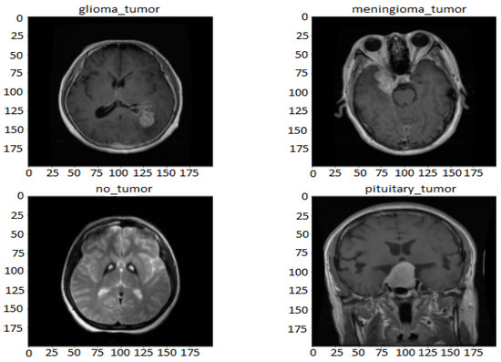 A CNN-Based Strategy to Classify MRI-Based Brain Tumors Using Deep ...