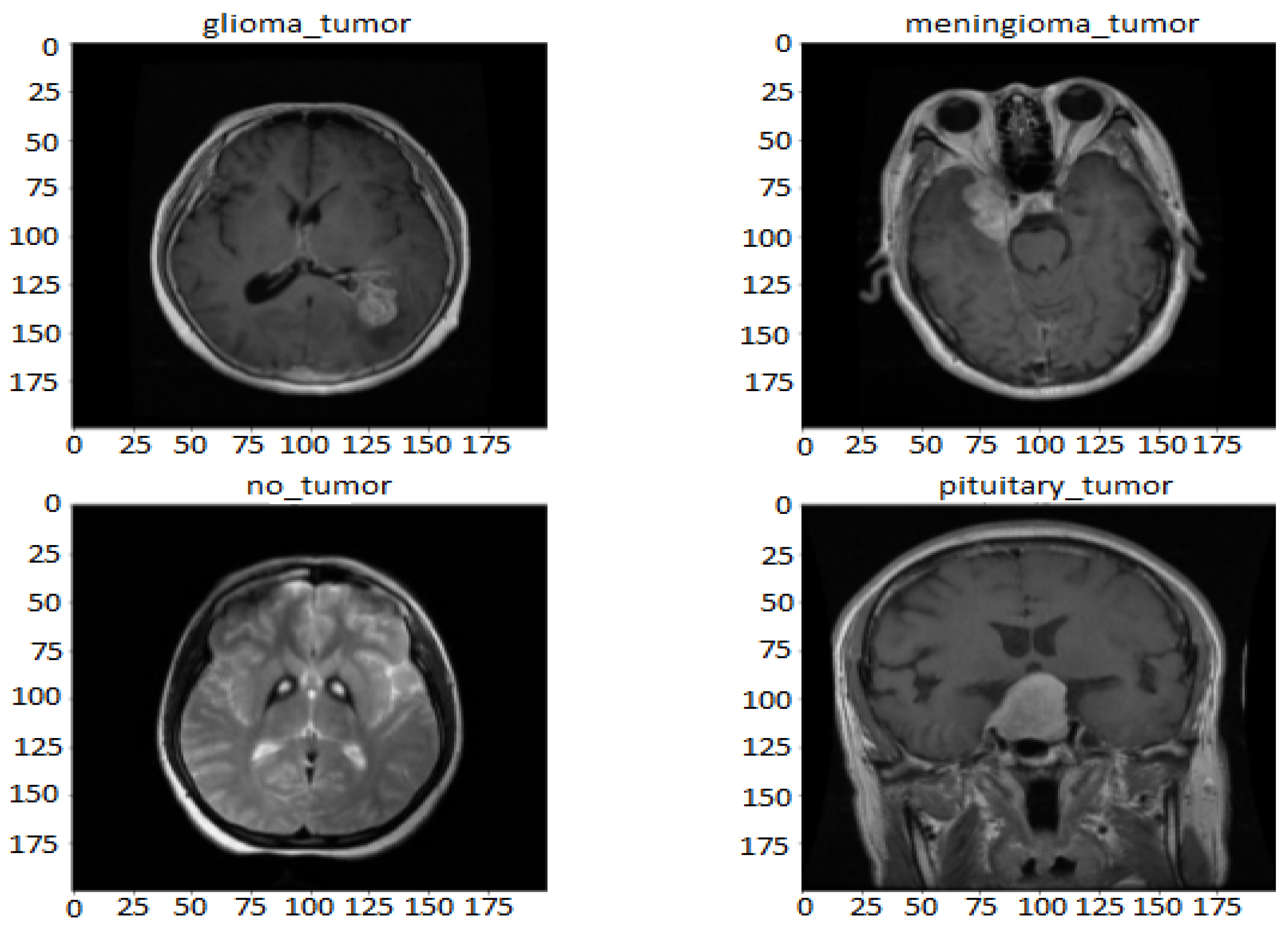 A CNN-Based Strategy to Classify MRI-Based Brain Tumors Using Deep ...