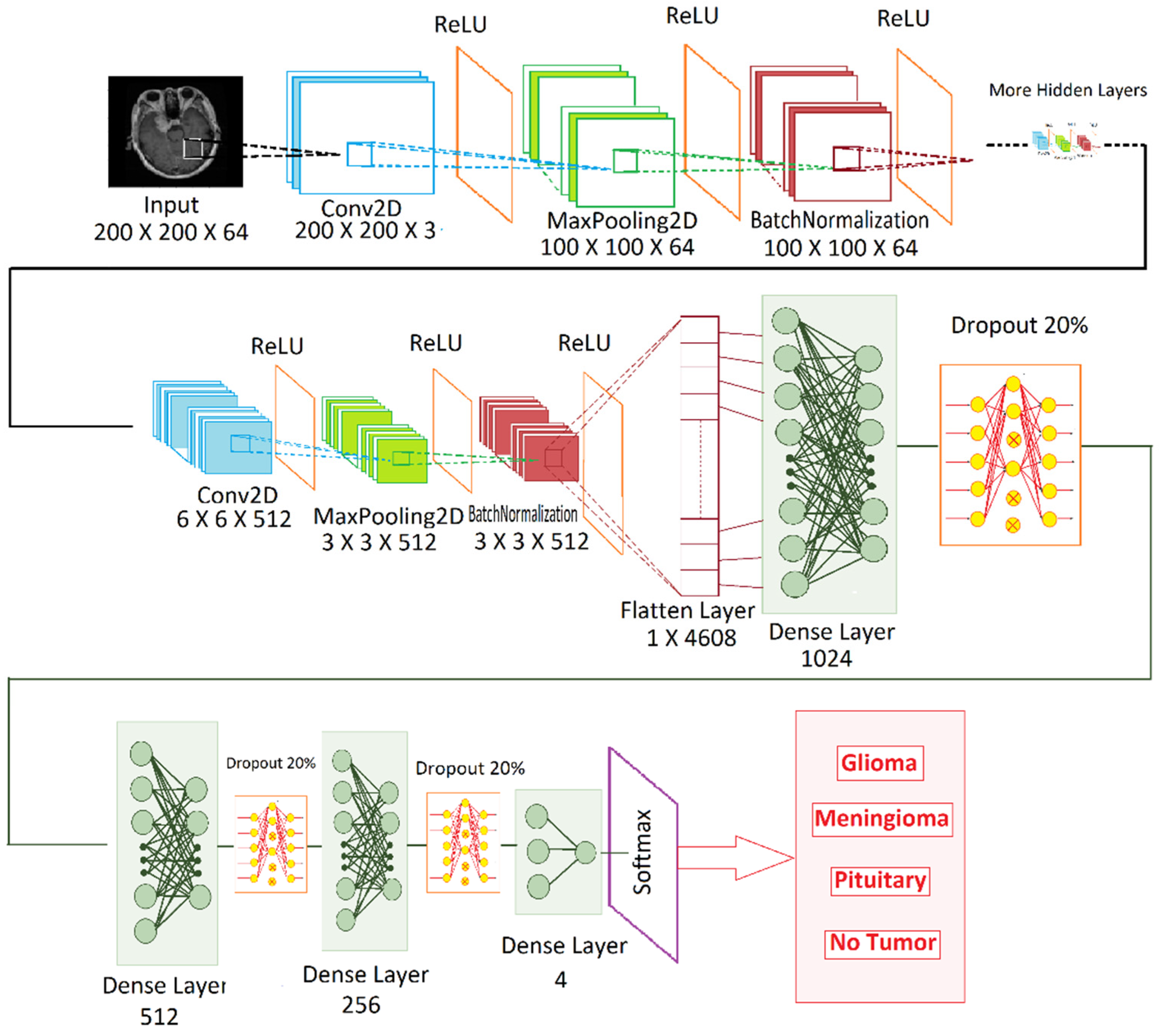 A CNN-Based Strategy to Classify MRI-Based Brain Tumors Using Deep Convolutional Network