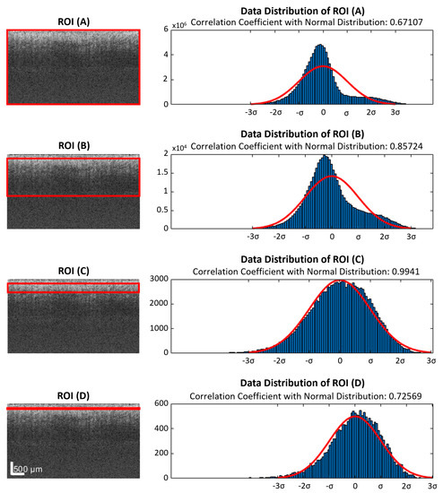 Windowed Eigen-Decomposition Algorithm for Motion Artifact Reduction in Optical Coherence ...