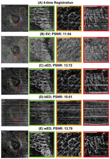 Windowed Eigen-Decomposition Algorithm for Motion Artifact Reduction in ...