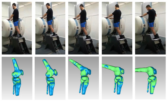 Applied Sciences | Free Full-Text | In-Vivo Quantification of Knee Deep ...