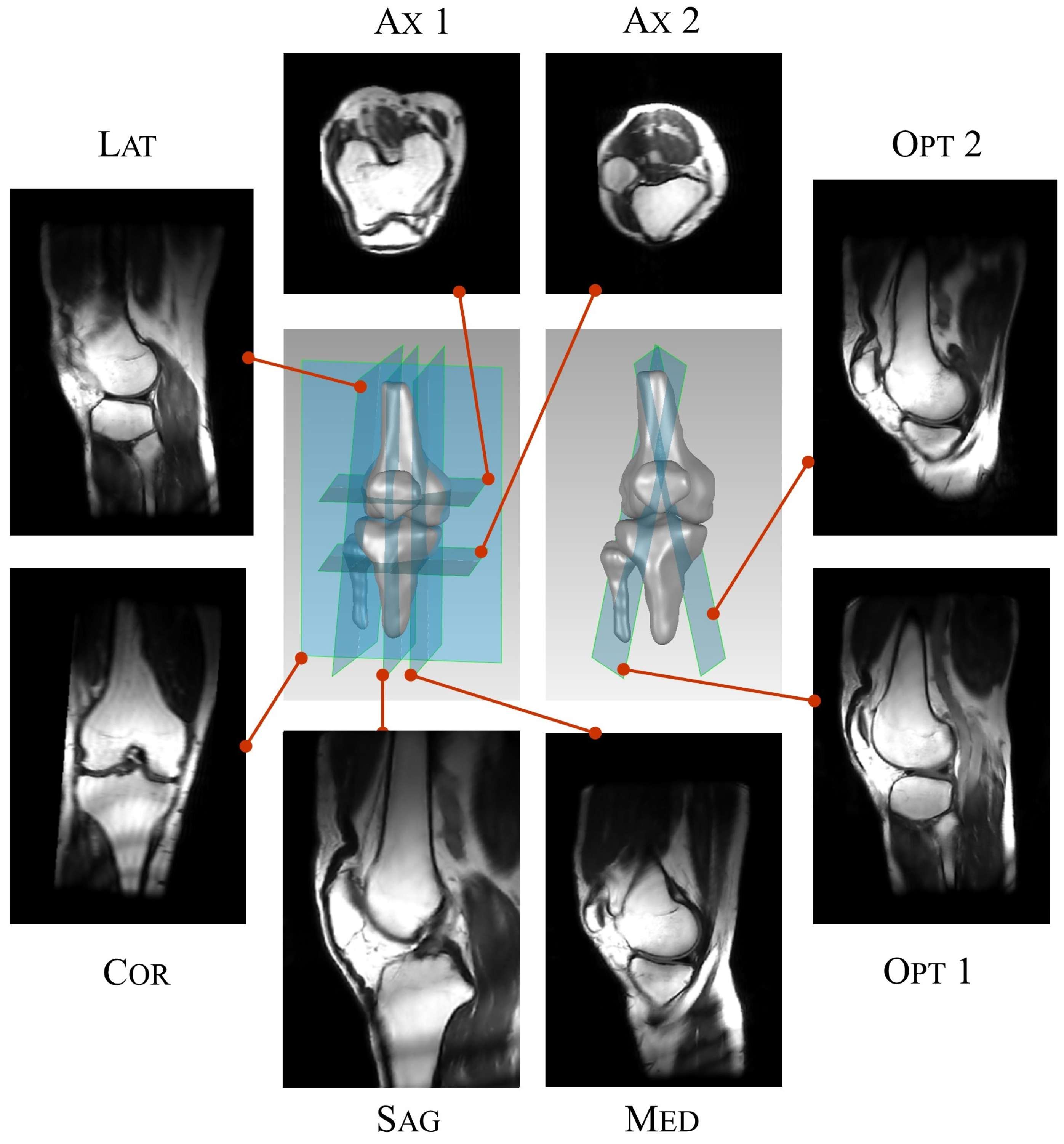 Applied Sciences | Free Full-Text | In-Vivo Quantification of Knee Deep ...
