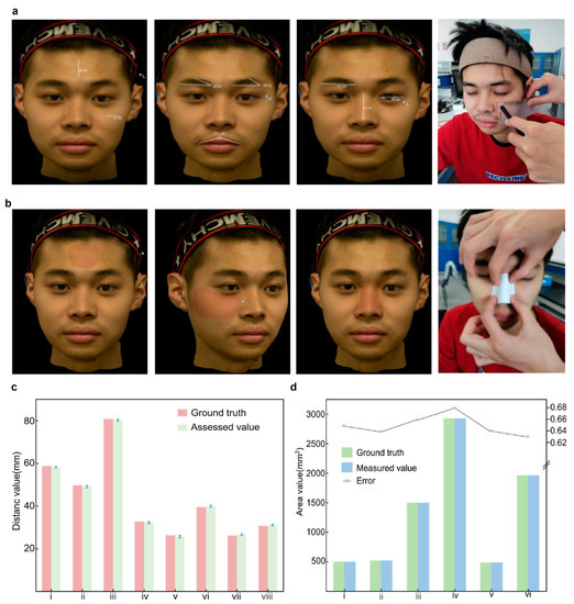 3D Facial Plastic Surgery Simulation: Based on the Structured Light