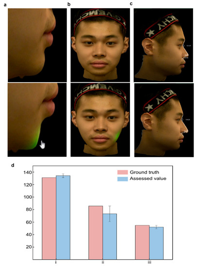 3D Facial Plastic Surgery Simulation: Based on the Structured Light