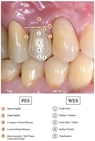 Long-Term Clinical and Radiographic Analysis of Platform Matching and ...