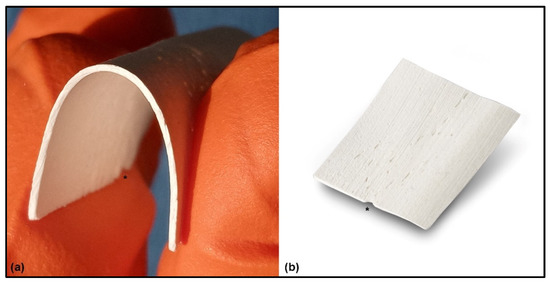 Restoration of Severe Bone and Soft Tissue Atrophy by Means of a ...