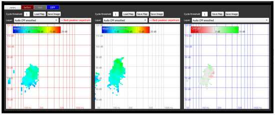 Do We Get What We Need from Clinical Acoustic Voice Measurements?