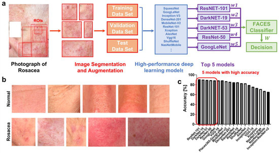 FACES: A Deep-Learning-Based Parametric Model to Improve Rosacea Diagnoses