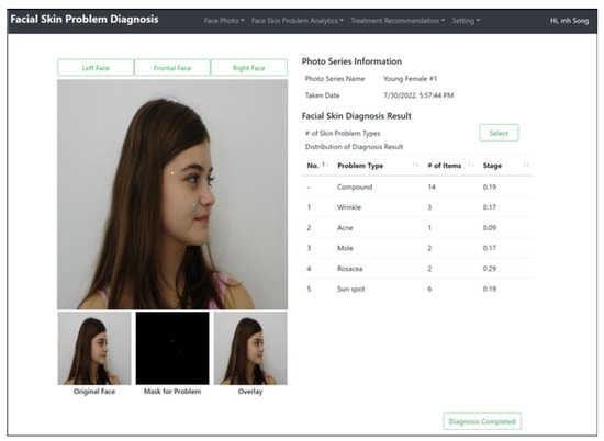 High Performing Facial Skin Problem Diagnosis with Enhanced Mask R-CNN and Super Resolution GAN