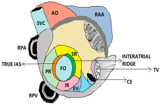 Experimental Analysis of Transseptal Puncture to Investigate the ...