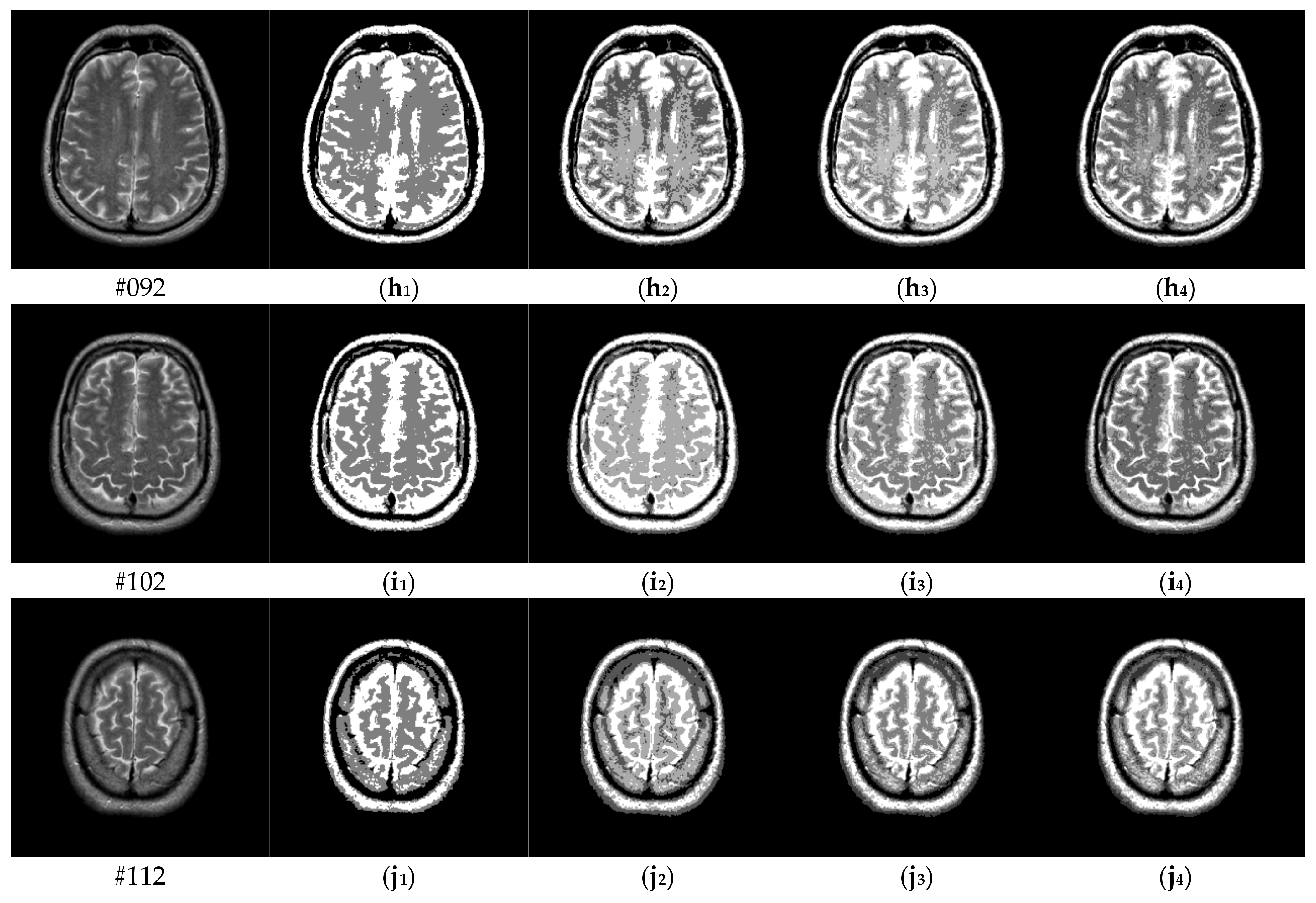 A Novel Interval Iterative Multi-Thresholding Algorithm Based on Hybrid Spatial Filter and ...