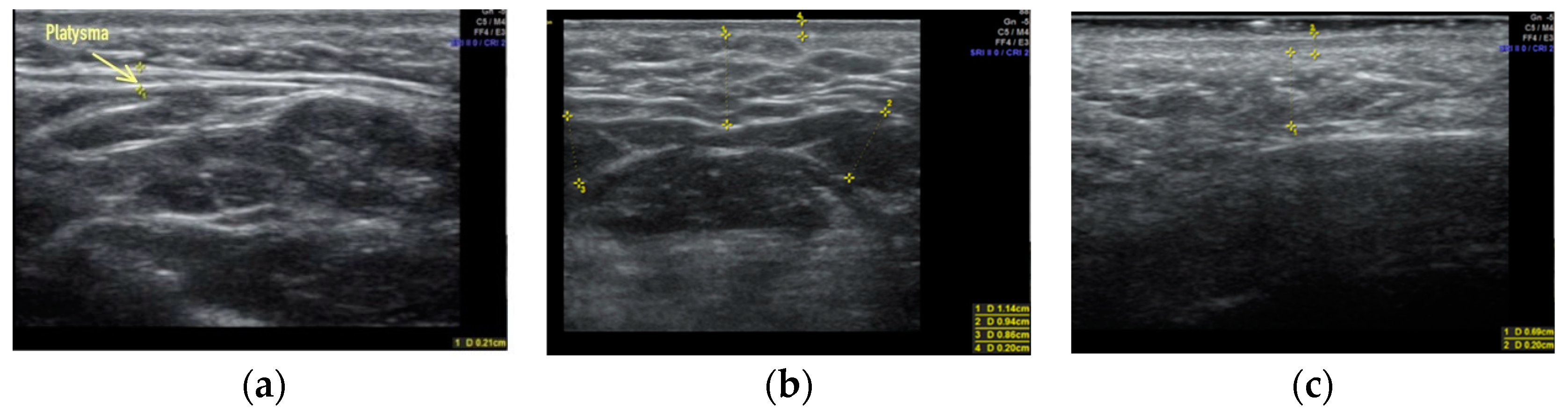 Applied Sciences Free Full Text Possibilities Of Ultrasound