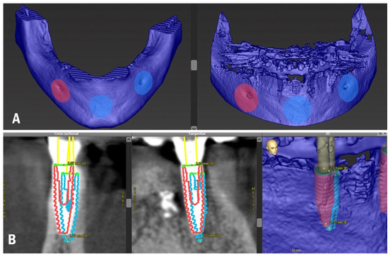 Applied Sciences | Free Full-Text | In Vivo and In Vitro Accuracy ...