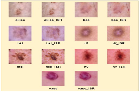 Applied Sciences | Free Full-Text | Skin Cancer Classification ...